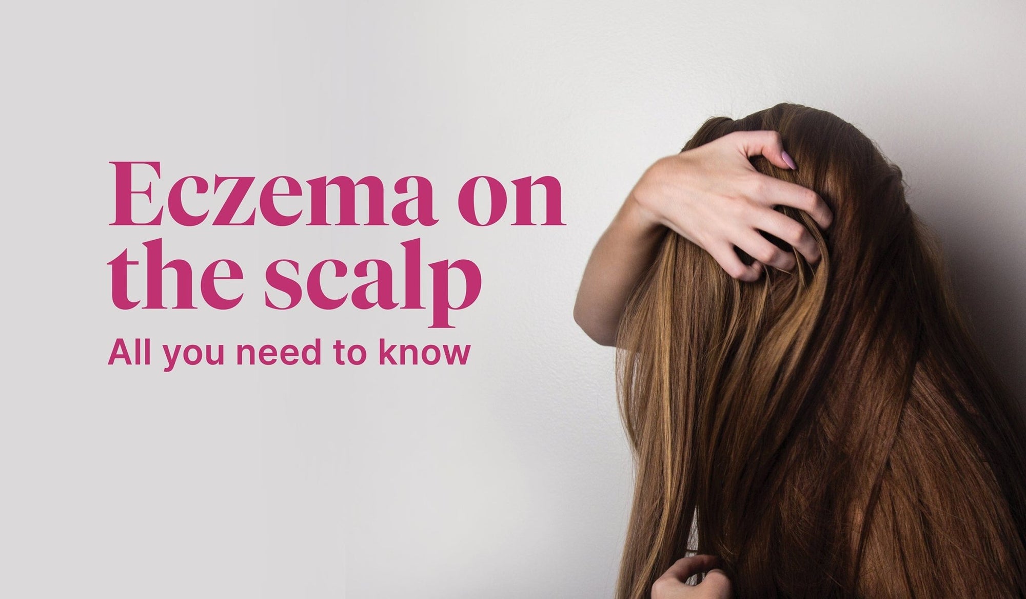 Scalp Eczema: Causes, Symptoms, Treatment – Hanna Sillitoe