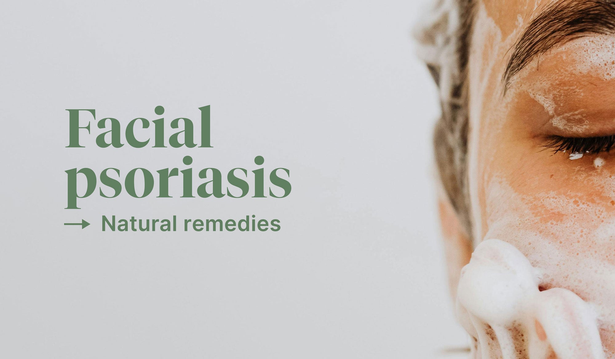 Natural Ways to Soothe Facial Psoriasis – Hanna Sillitoe