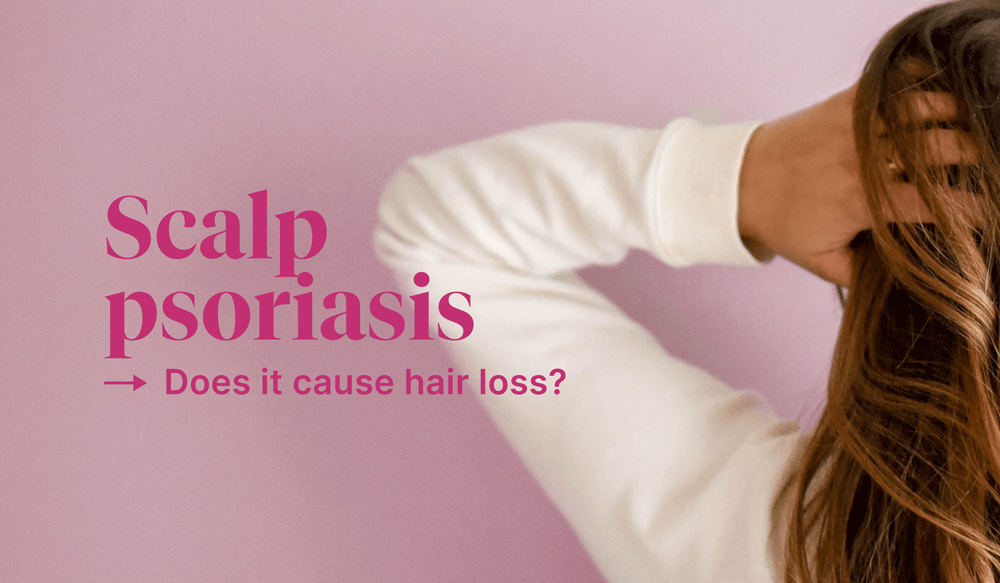 Scalp Psoriasis: Does It Cause Hair Loss? – Hanna Sillitoe