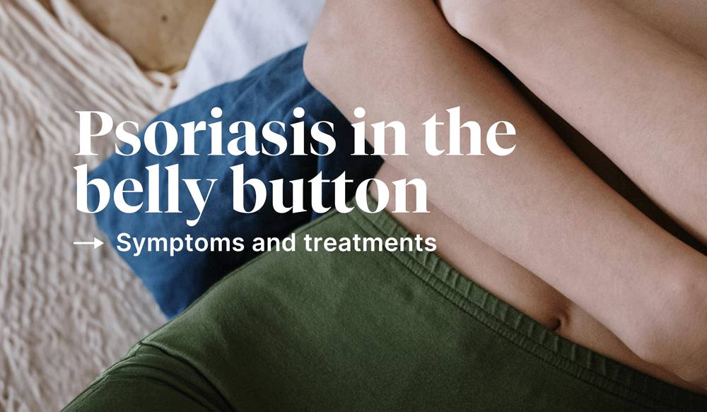 Psoriasis in Belly Button: Symptoms and Treatments – Hanna Sillitoe