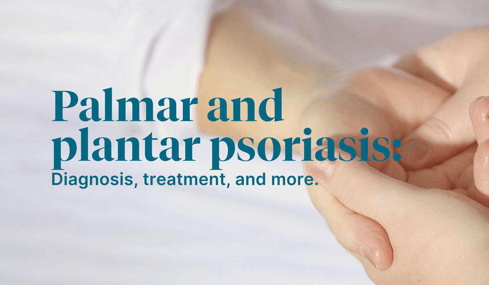 Palmar and Plantar Psoriasis: Diagnosis, Treatment, and More – Hanna ...